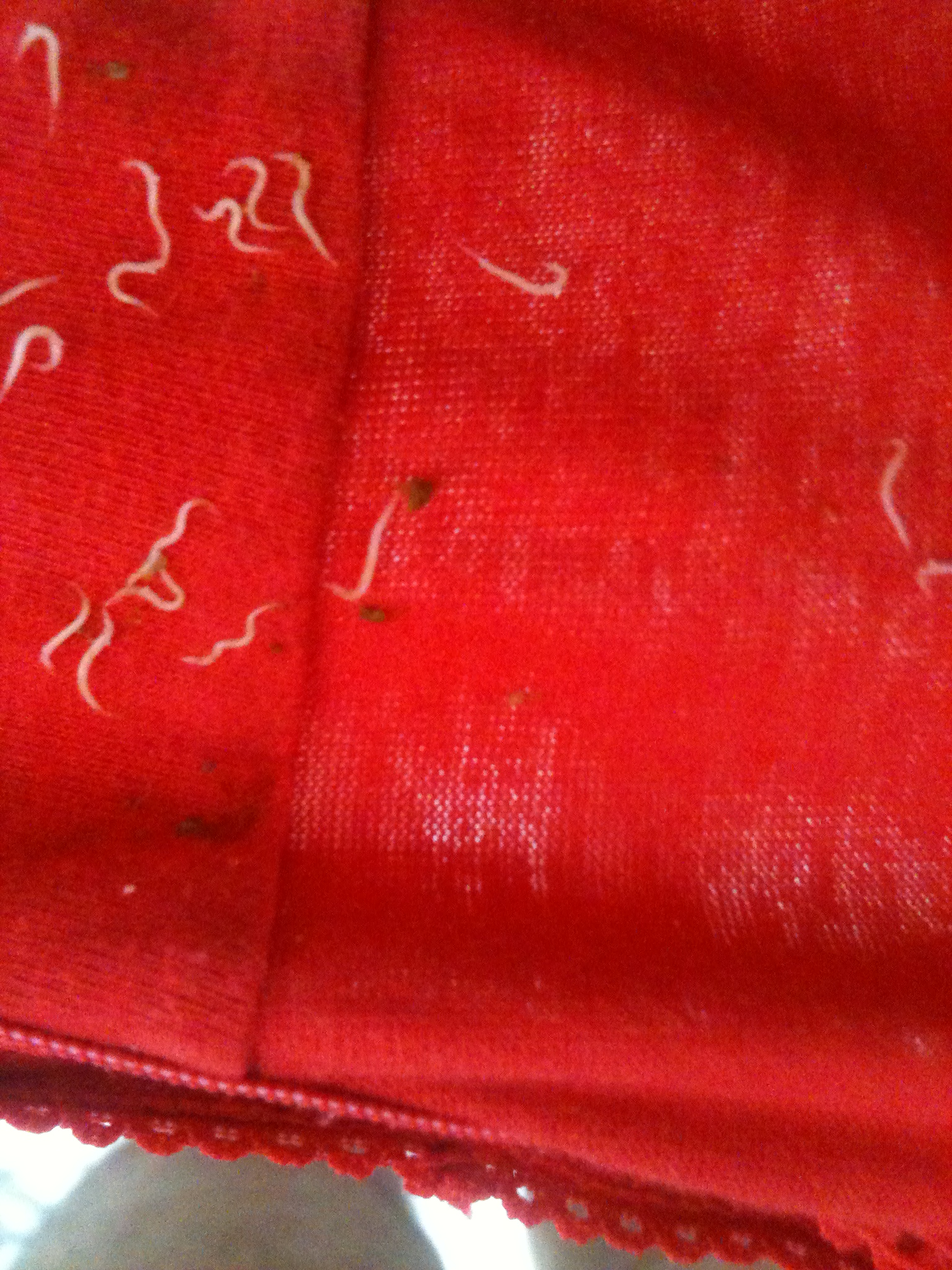 C'EST QUOI L'OXYUROSE ? - Santé des jeunes